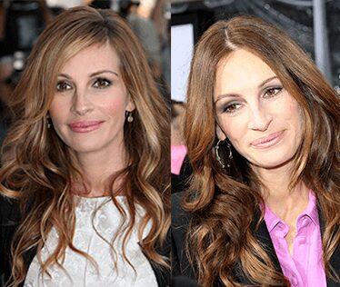 Middle Part Vs Side Part Saga - New You